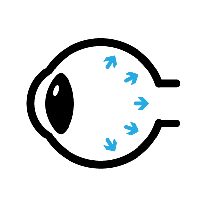 Uveitis management and treatment| Moorfields Eye Hospitals UAE